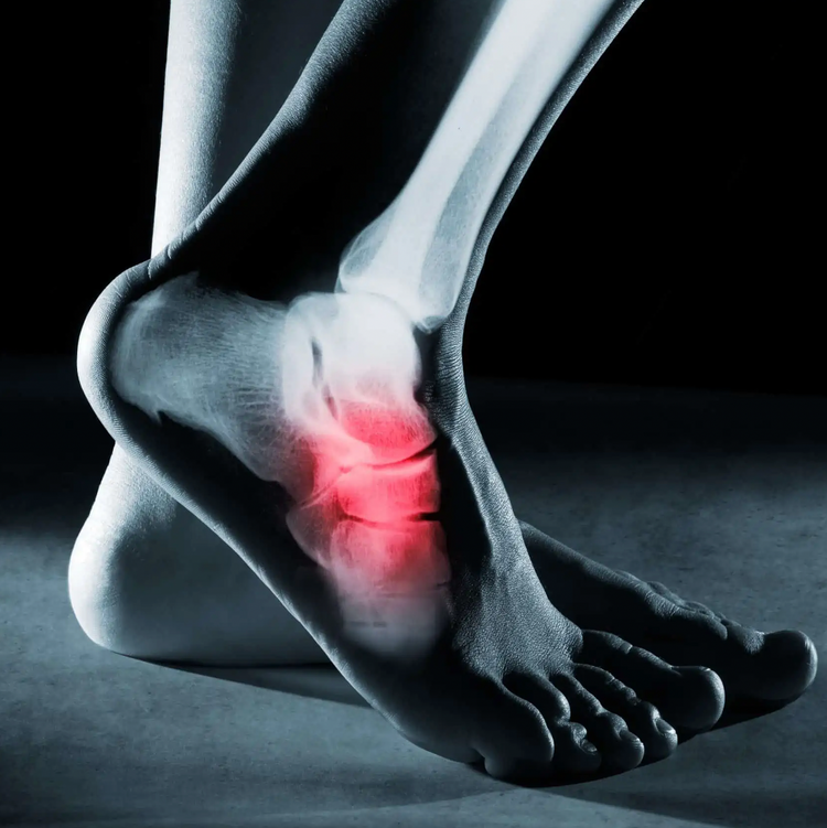 Nerve Balm™ Neuropathy Cream | Order Nerve Pain Cream - Lune